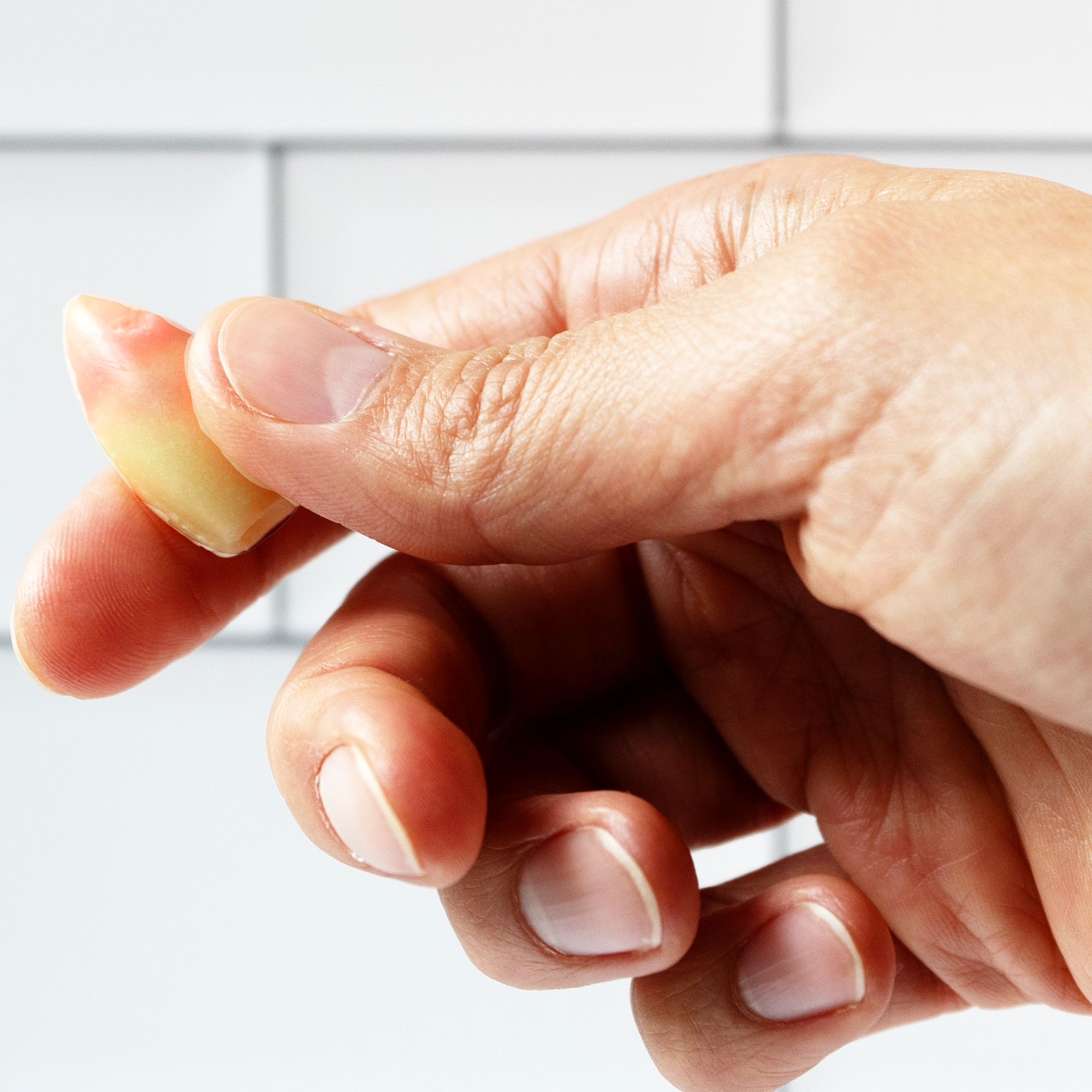 5 Links Between Hormonal Contraceptives & UTI - Stop UTI Forever